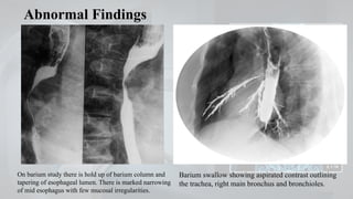 Barium Swallow Radiographic Procedure.pptx