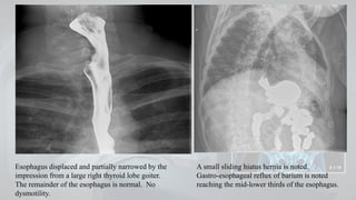 Barium Swallow Radiographic Procedure.pptx
