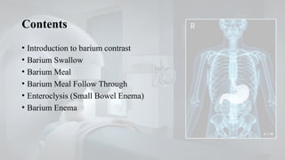 Barium Swallow Radiographic Procedure.pptx
