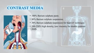 Barium Swallow Radiographic Procedure.pptx