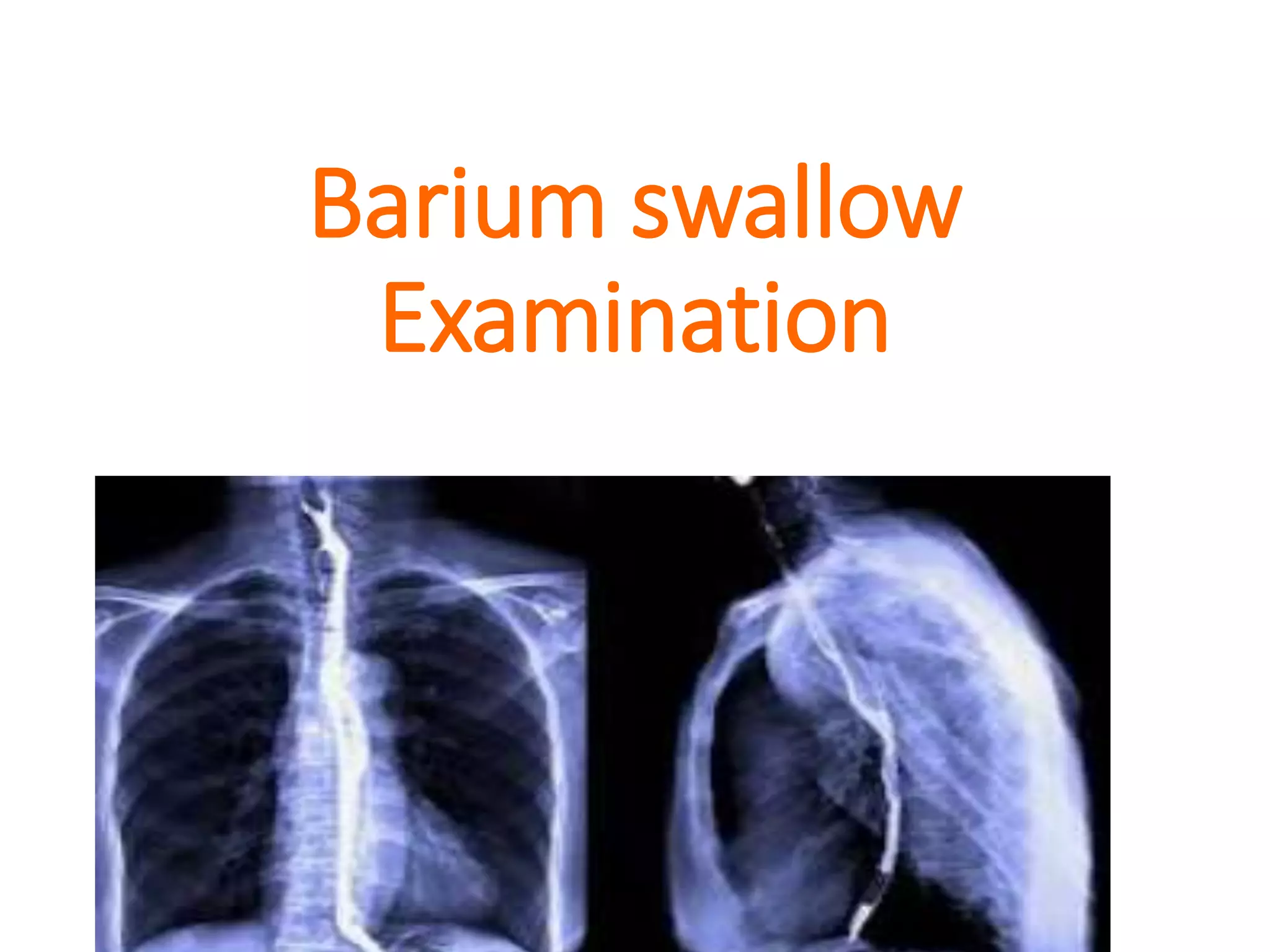 Barium swallow examination | PPTX