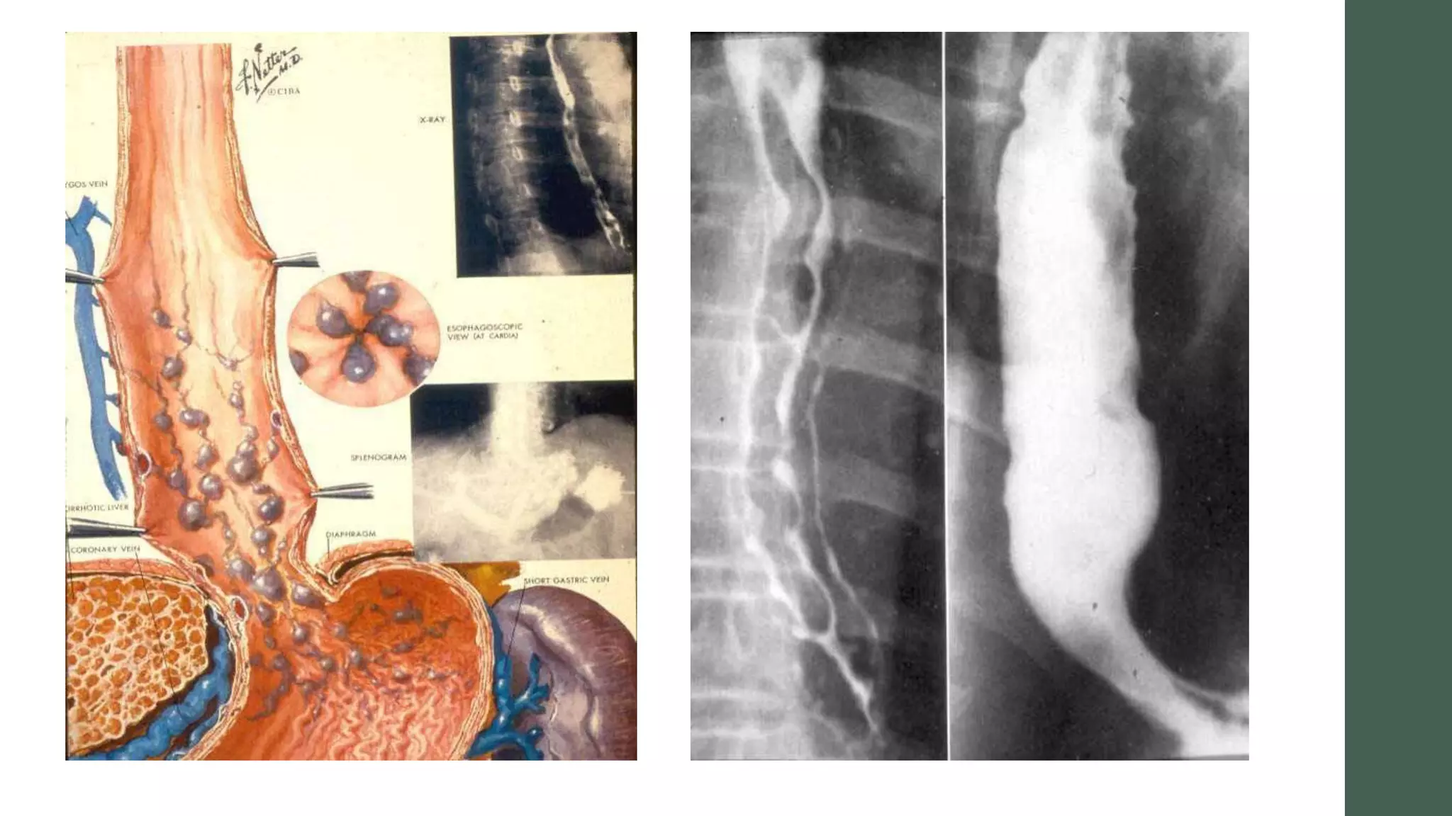 barium swallow EDIT.pptx