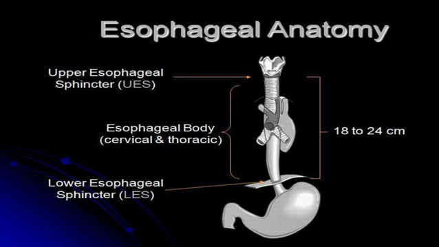 barium swallow EDIT.pptx