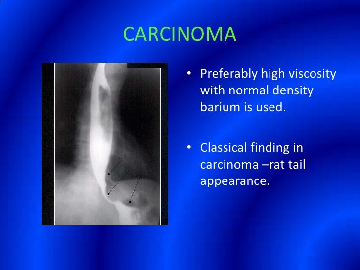 Barium Swallow Presentation