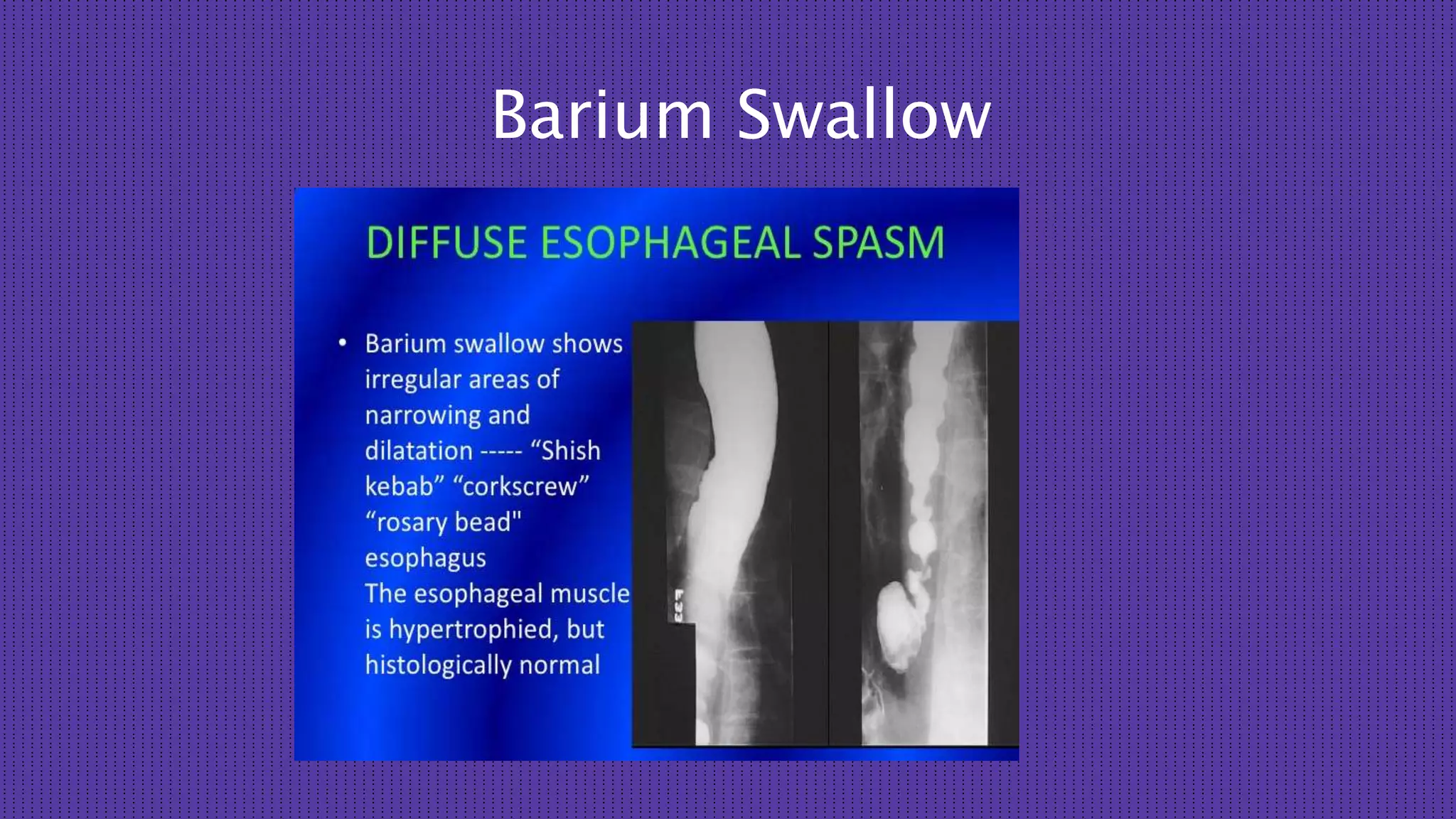 Barium swallow. Srinivas Rao Khorfakkhan hospital | PPT