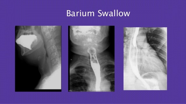 Barium swallow. Srinivas Rao Khorfakkhan hospital