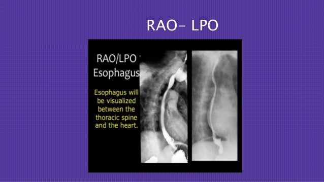 Barium swallow. Srinivas Rao Khorfakkhan hospital