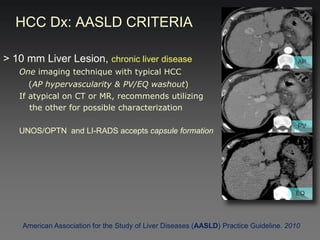 Baron pitfalls in liver imaging cirrhosis_rsna 2014 | PPT