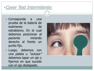 Cover Test Para Estrabismo | PPTX