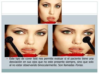 Cover Test Para Estrabismo | PPTX