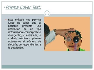 Cover Test Para Estrabismo | PPTX