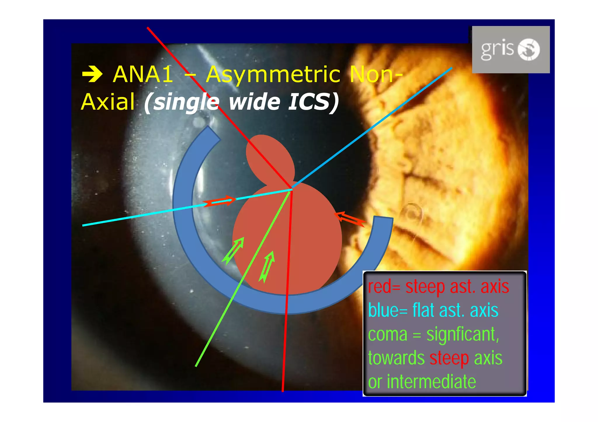 The SA.ANA classification | PDF