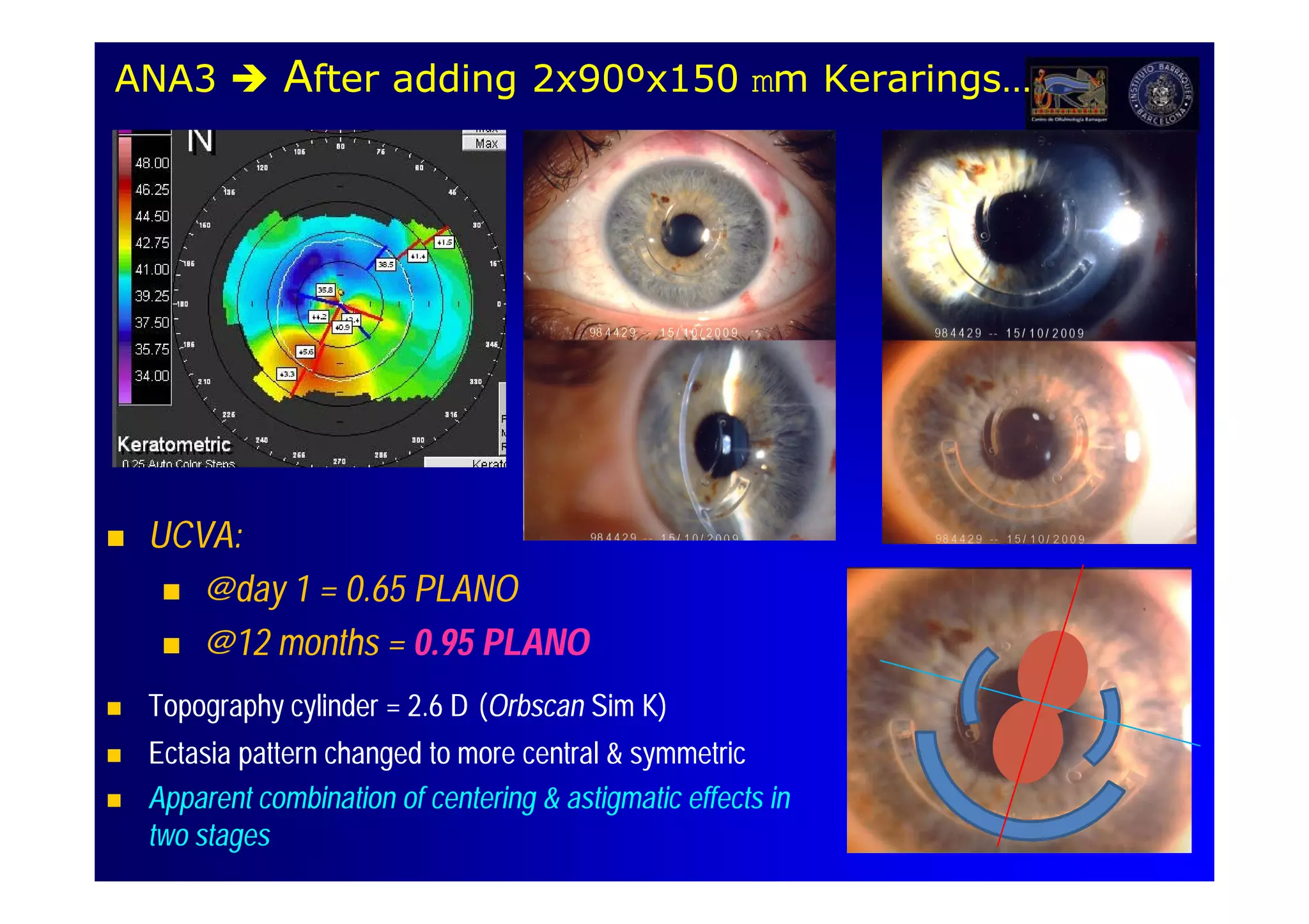 The SA.ANA classification | PDF