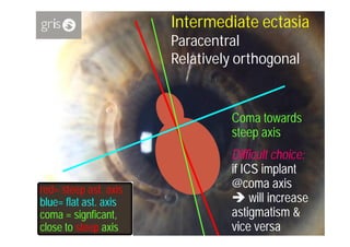 The SA.ANA classification | PDF | Eye and Vision Conditions | Diseases ...
