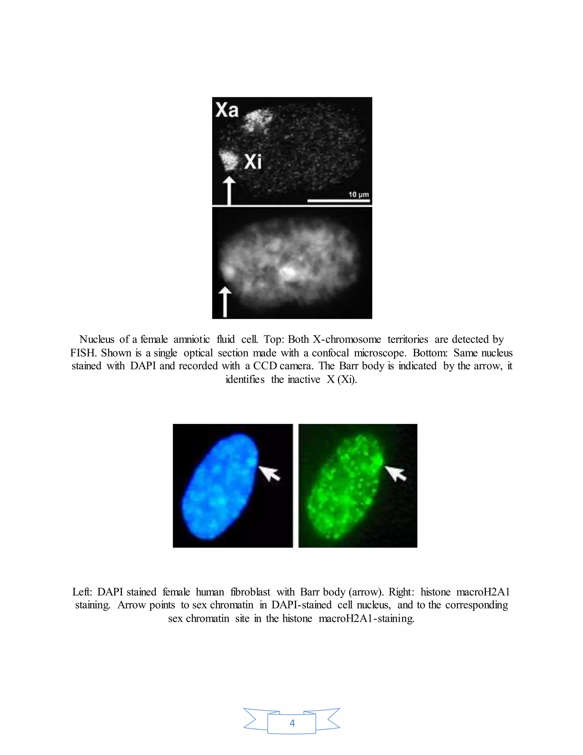 Barr Body Staining | DOCX