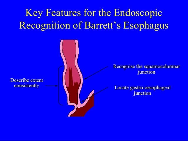 L'esofago di Barrett - Gastrolearning®