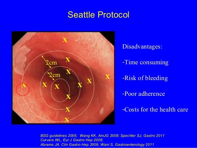 L'esofago di Barrett - Gastrolearning®