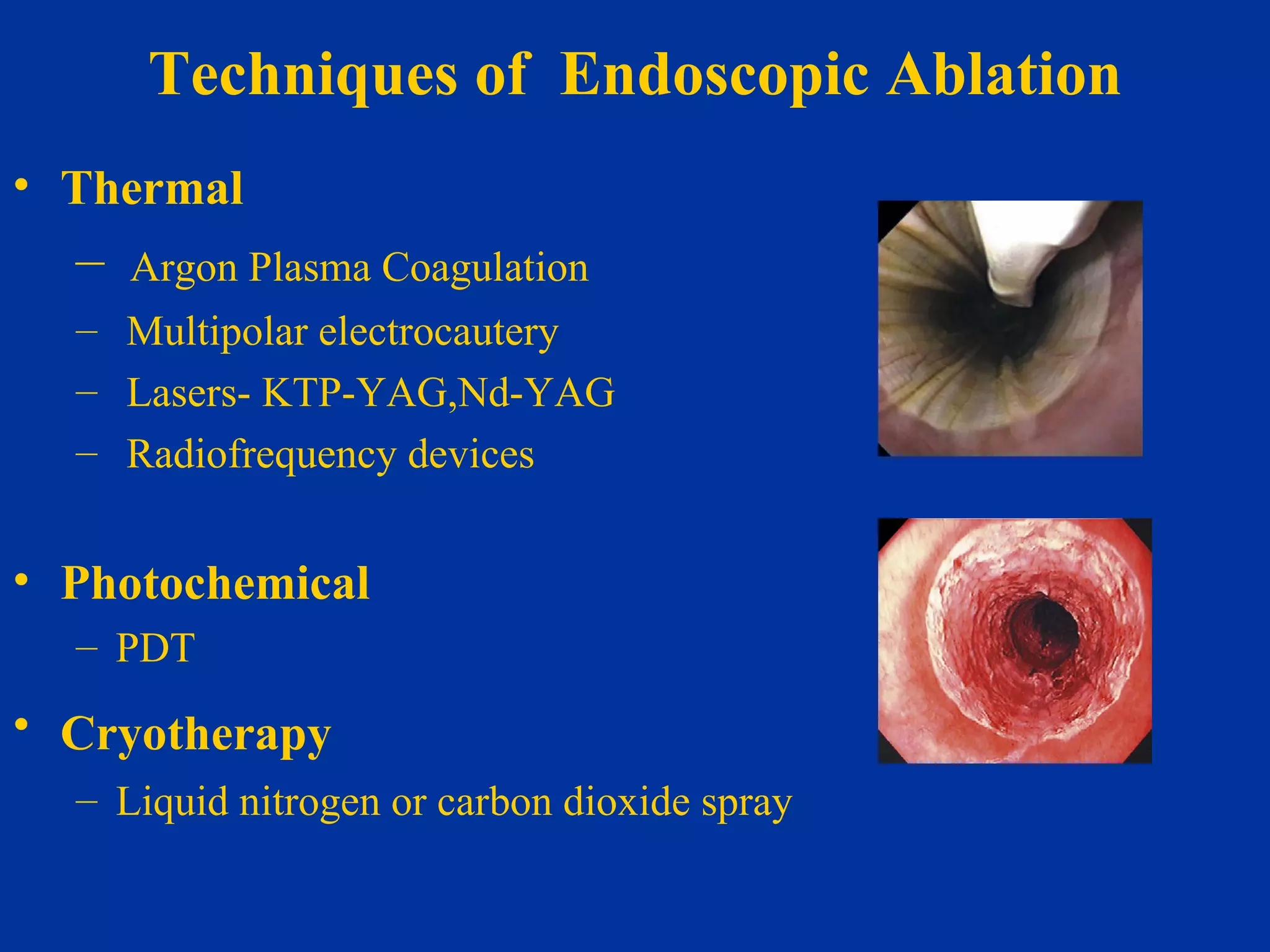 Barretts Brief Version For Upload | PPT