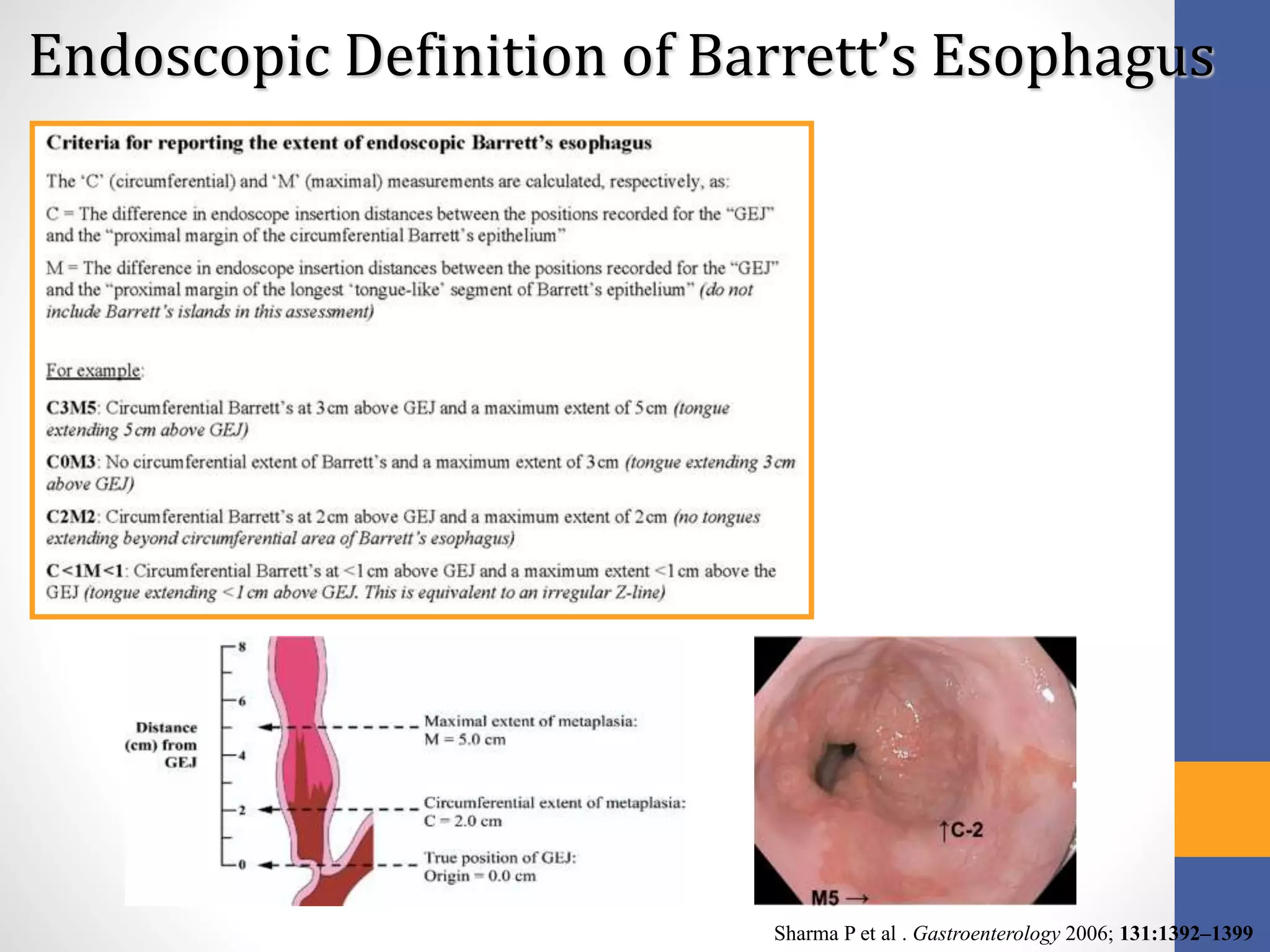 Dall'esofago di Barrett all'adenocarcinoma: fisiopatologia e diagnosi ...