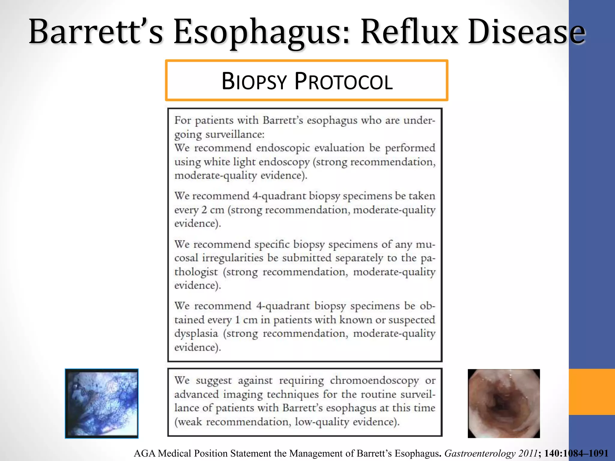 Dall'esofago di Barrett all'adenocarcinoma: fisiopatologia e diagnosi ...