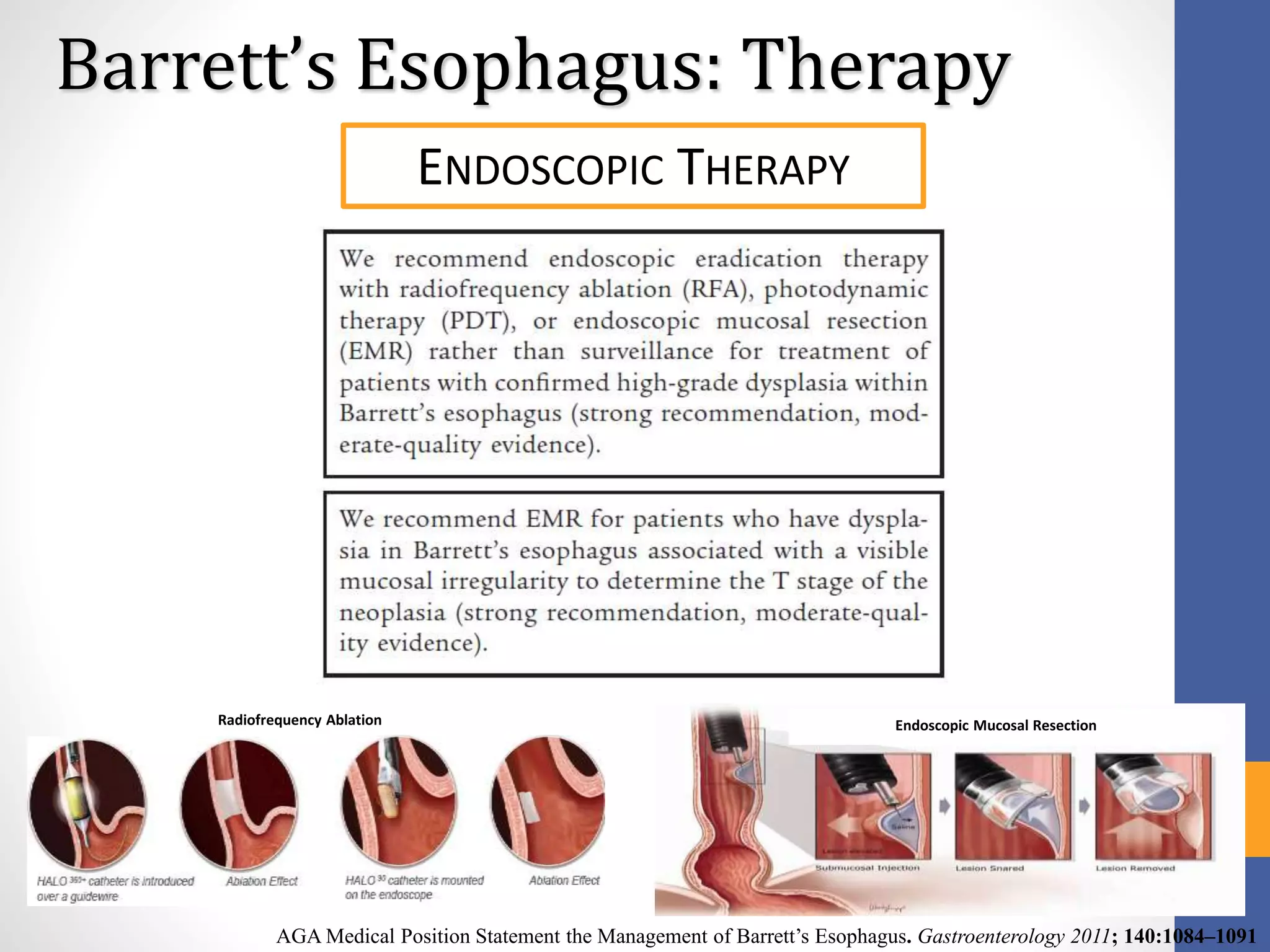 Dall'esofago di Barrett all'adenocarcinoma: fisiopatologia e diagnosi ...