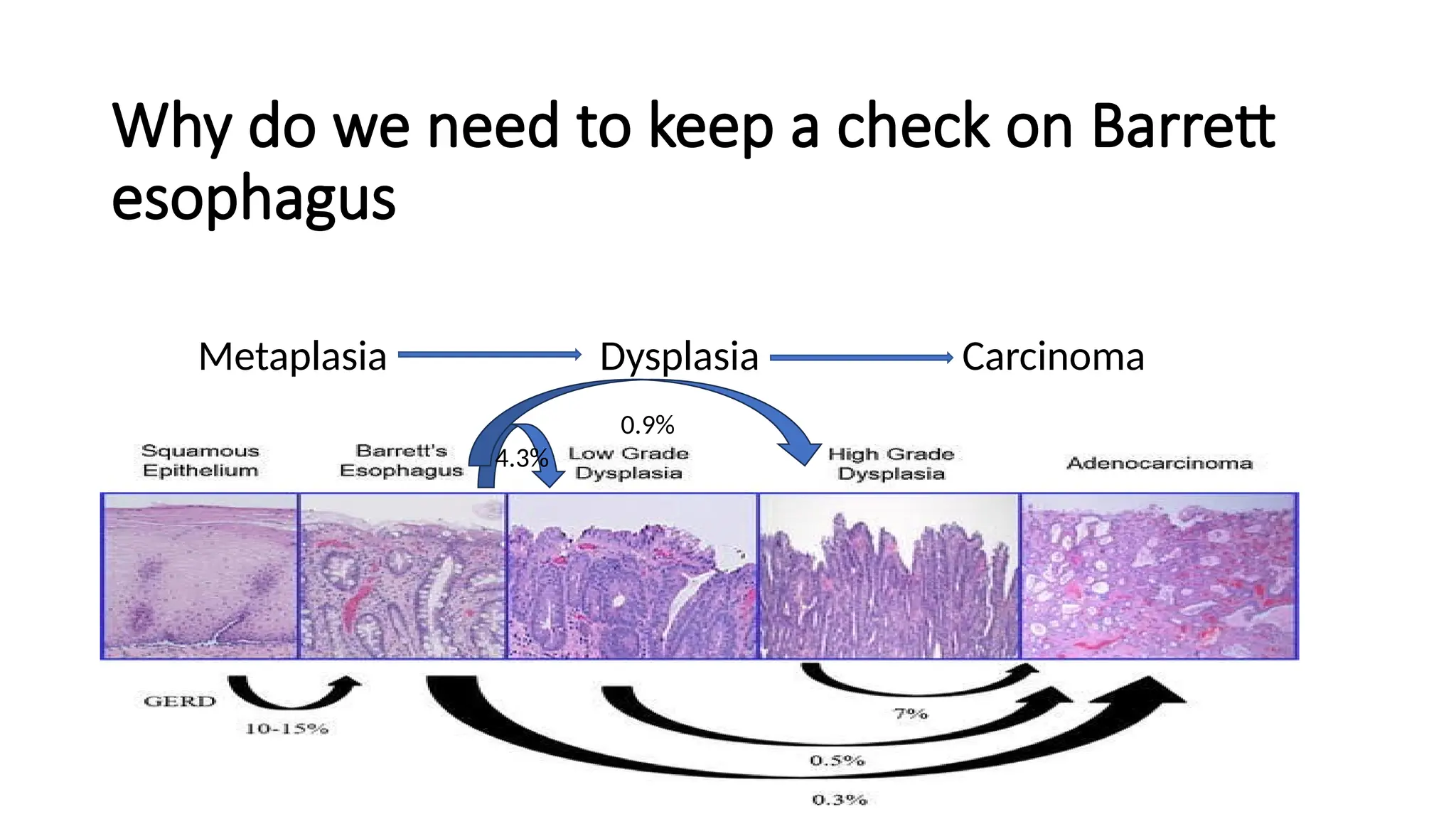 Barretts Esophagus -Diagnosis & management .pptx