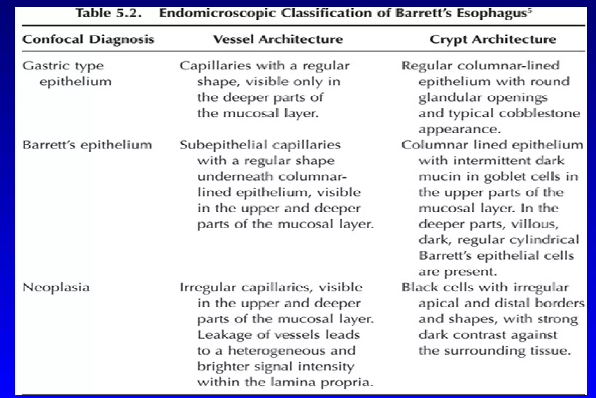 Barrett's esophagus; guidelines & new endoscopic techniques | PPT
