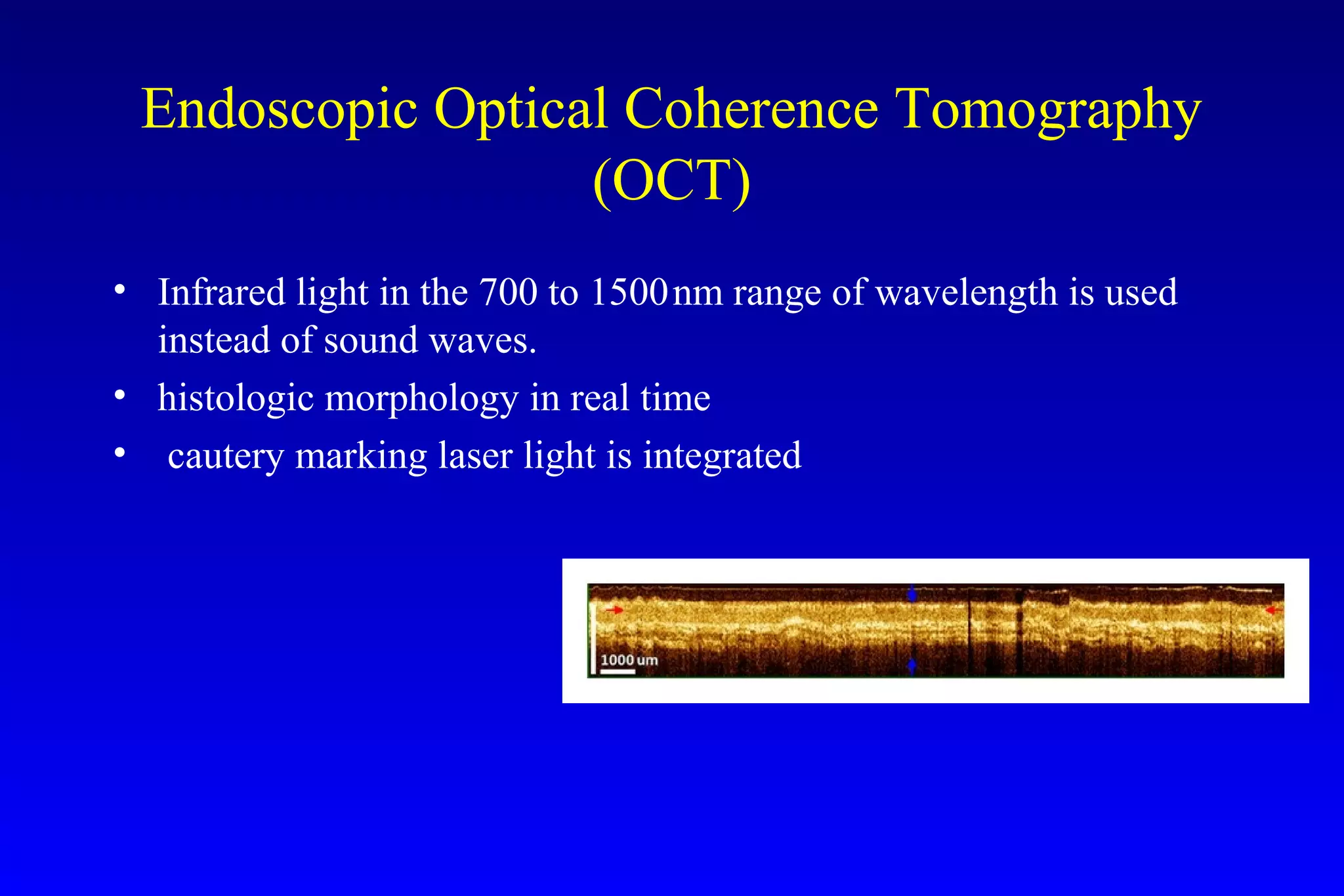 Barrett's esophagus; guidelines & new endoscopic techniques | PPT