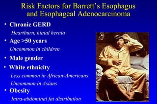 Barrett's esophagus; guidelines & new endoscopic techniques | PPT