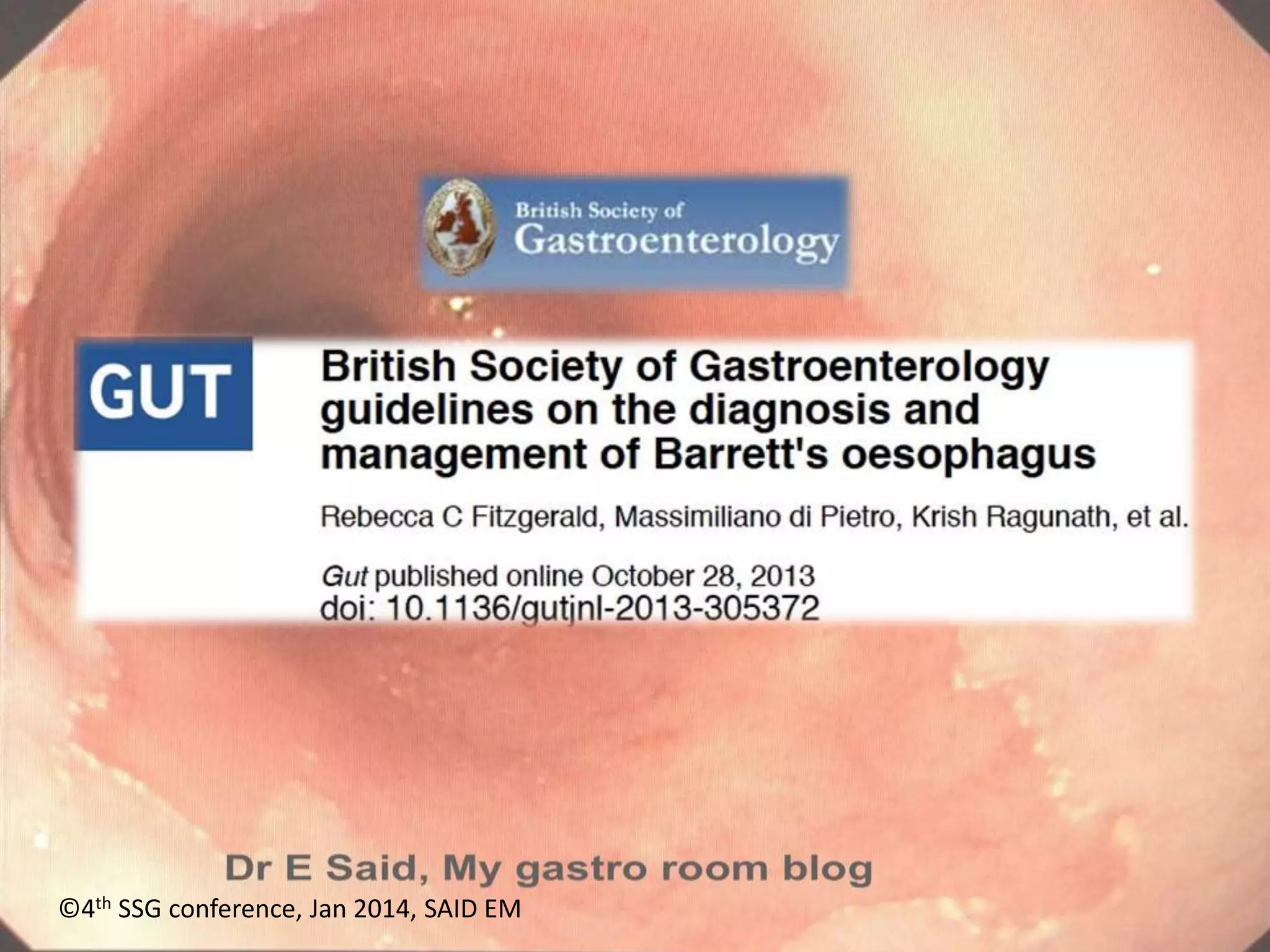 Barrett’s surveillance and early management of ca oesophagus | PPTX