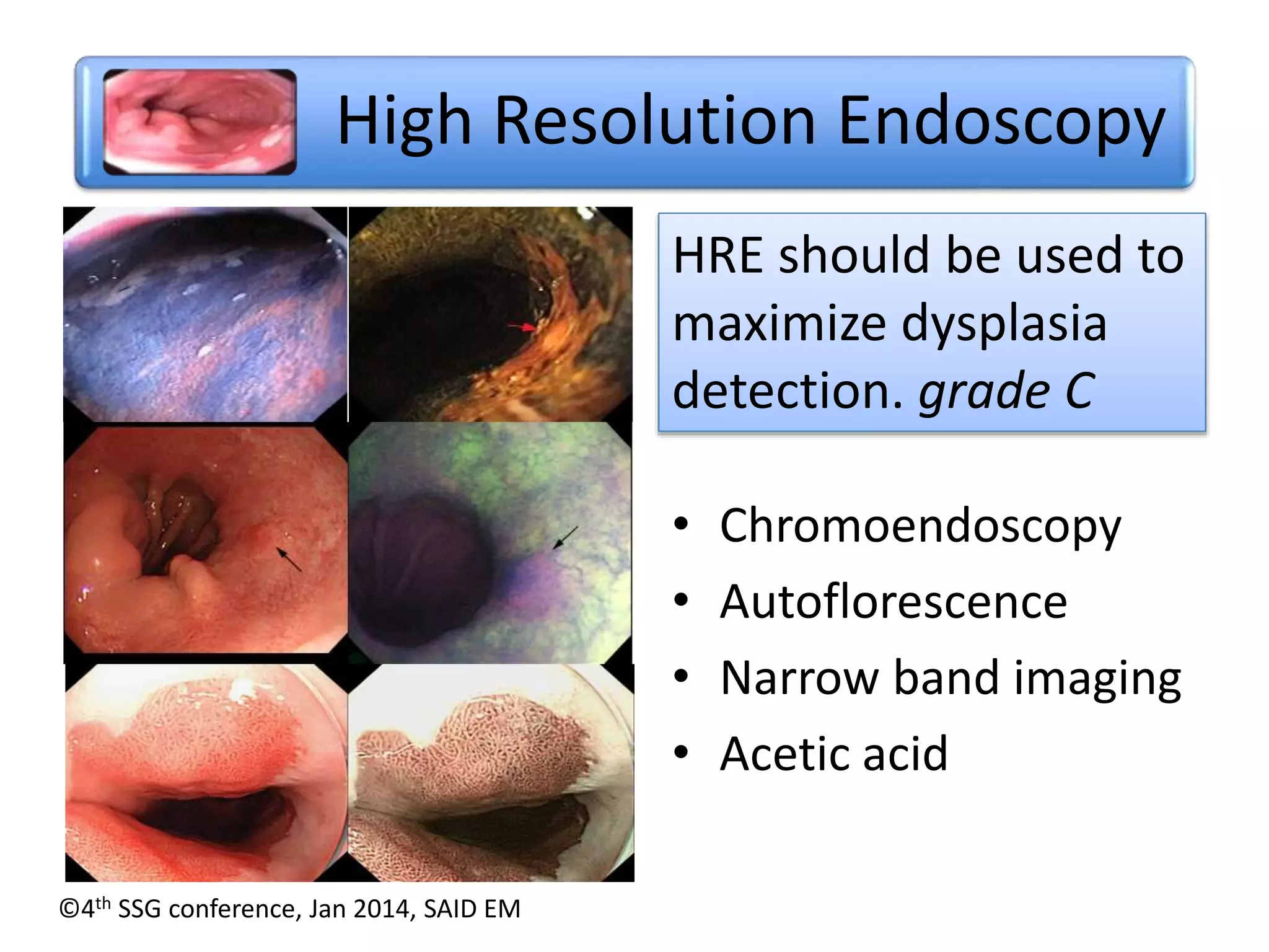 Barrett’s surveillance and early management of ca oesophagus | PPTX