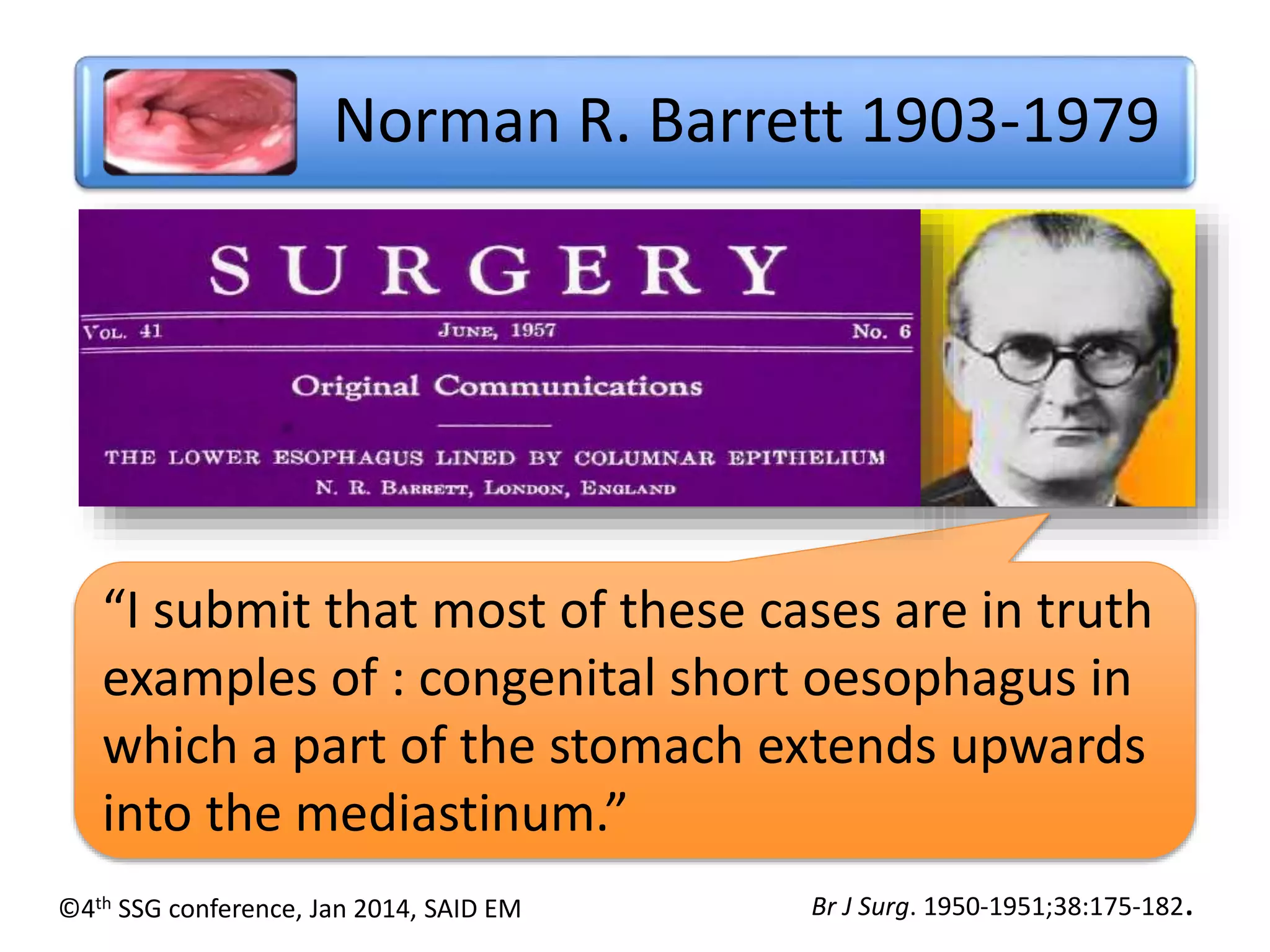 Barrett’s surveillance and early management of ca oesophagus | PPTX