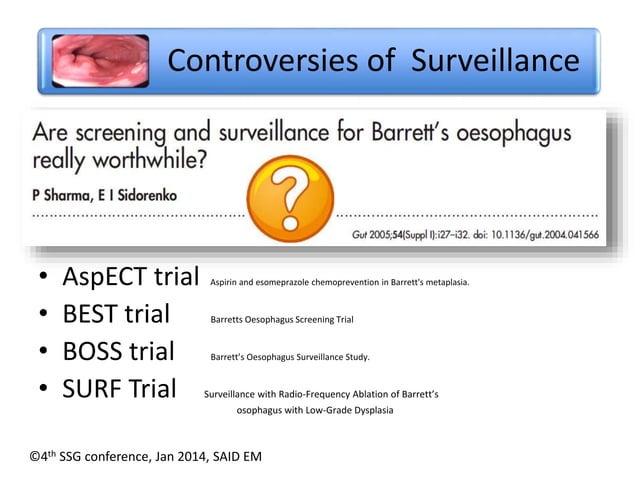 Barrett’s surveillance and early management of ca oesophagus | PPTX ...