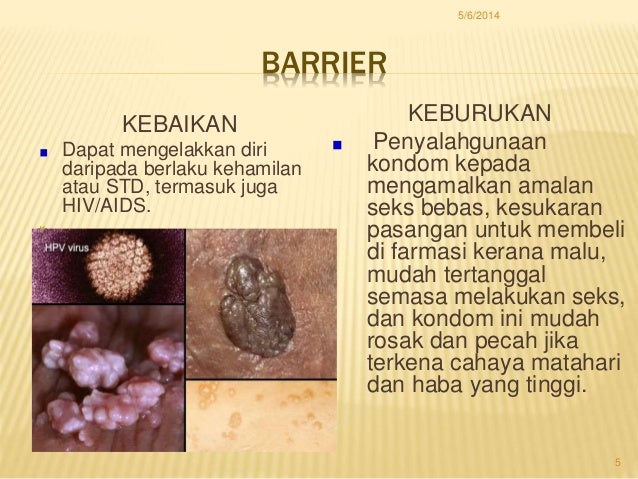 Barrier method for Planning Family