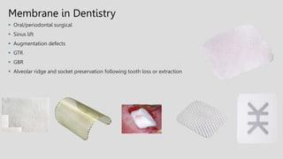 Barrier membranes in regenerative periodontal and implant surgeries ...
