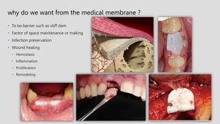 Barrier membranes in regenerative periodontal and implant surgeries.pptx