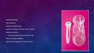 Barrier methods of contraception | PDF