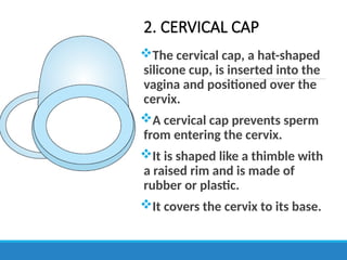Barrier methods of Contraception- obg ppt | PPTX