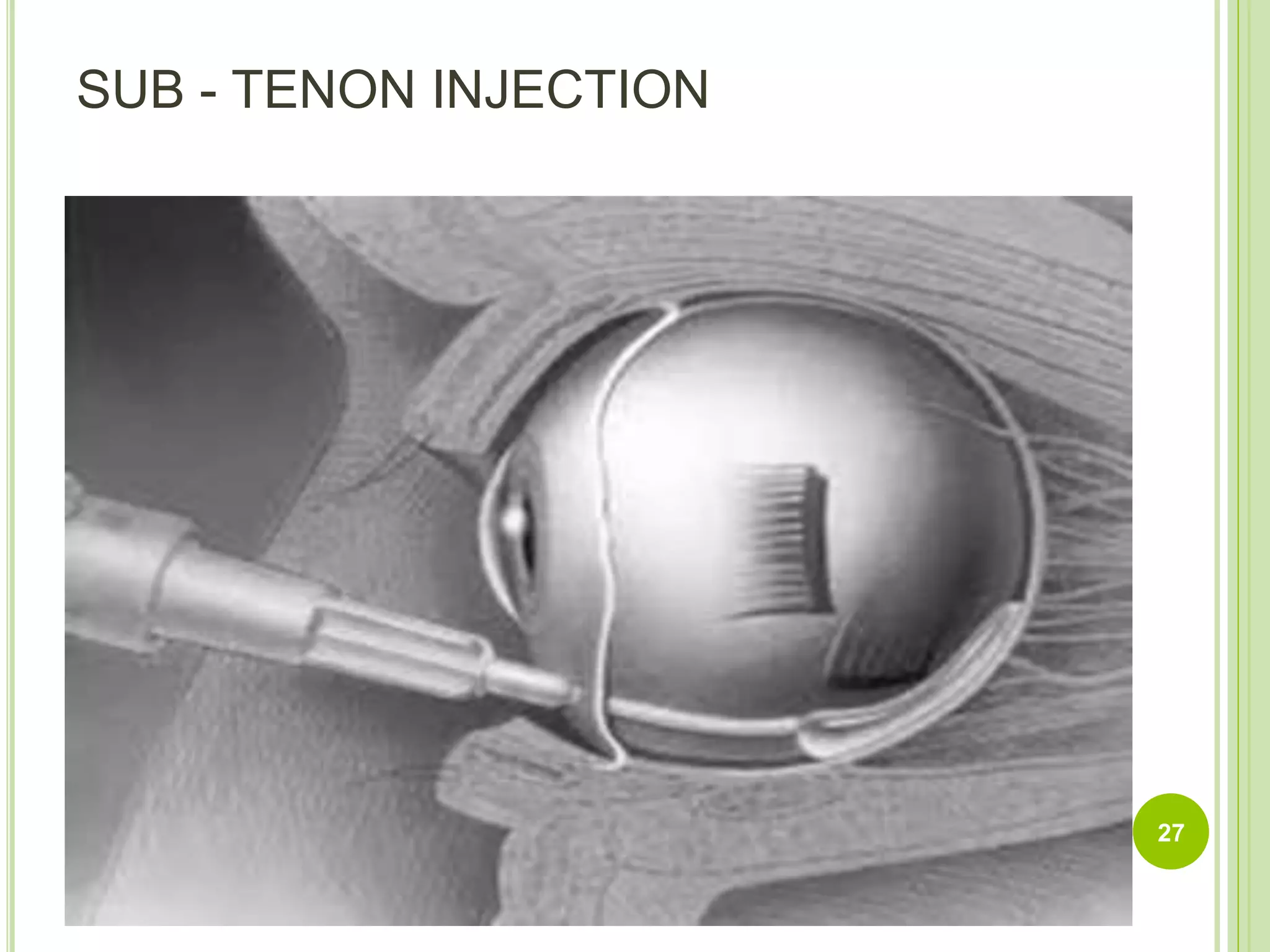 Barriers and routes of occular drug delivery system | PPTX
