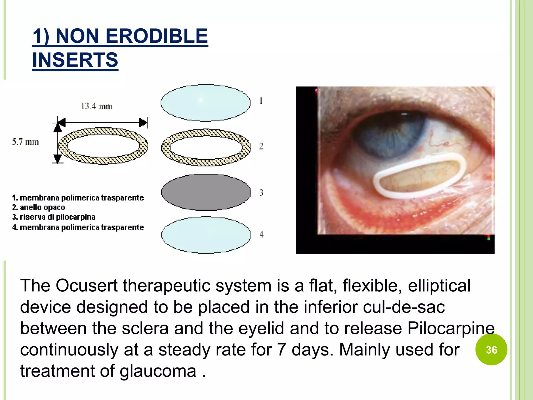 Barriers and routes of occular drug delivery system | PPTX