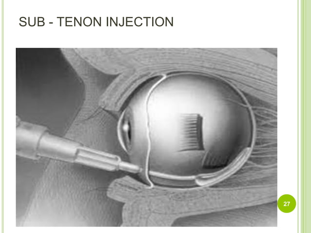 Barriers and routes of occular drug delivery system | PPTX