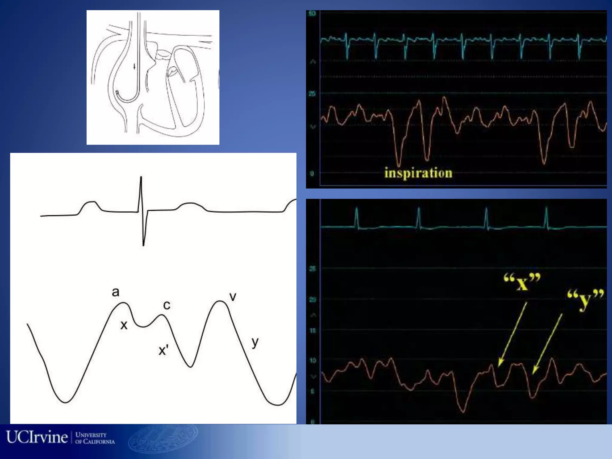 Barseghia-Basic-Hemodynamics.pptx