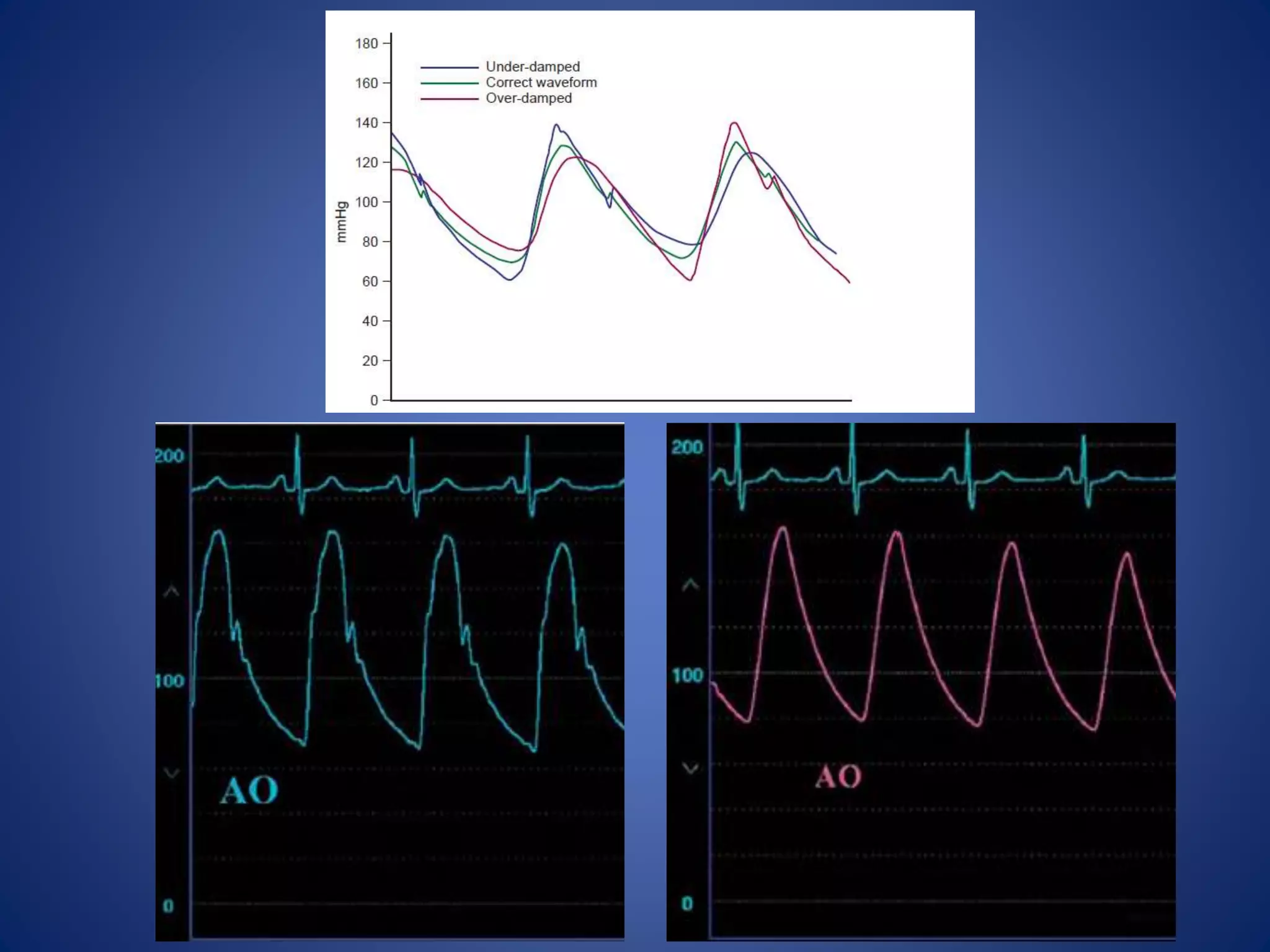 Barseghia-Basic-Hemodynamics.pptx