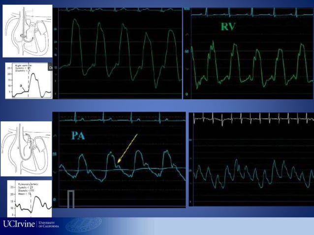 Barseghia-Basic-Hemodynamics.pptx
