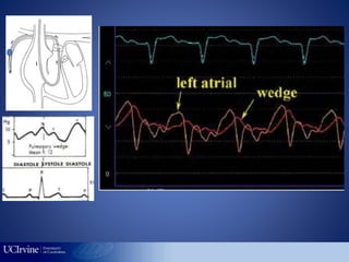Barseghia-Basic-Hemodynamics.pptx