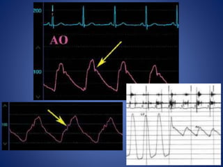 Barseghia-Basic-Hemodynamics.pptx