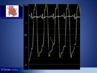 Barseghia-Basic-Hemodynamics.pptx