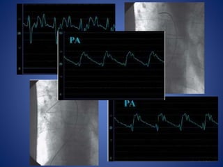 Barseghia-Basic-Hemodynamics.pptx