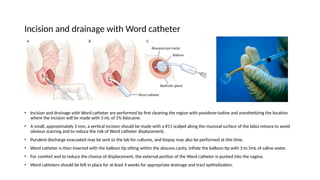 Bartholin cyst / kista bartholin ppt obgyn | PPTX