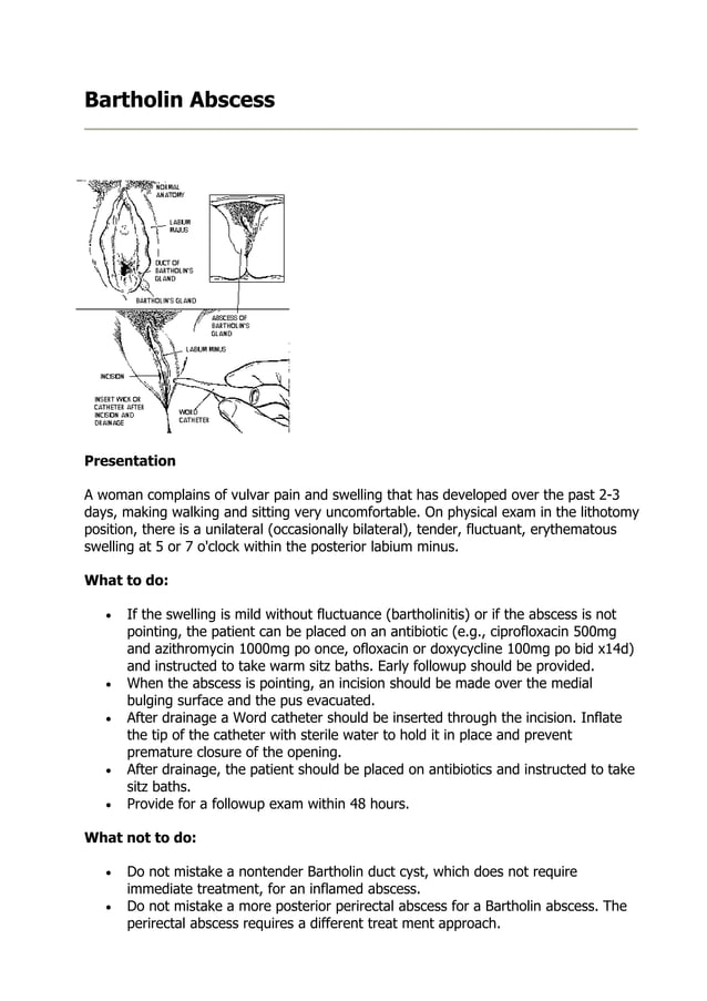 Bartholin Abscess | DOC | Infectious Diseases | Diseases and Conditions
